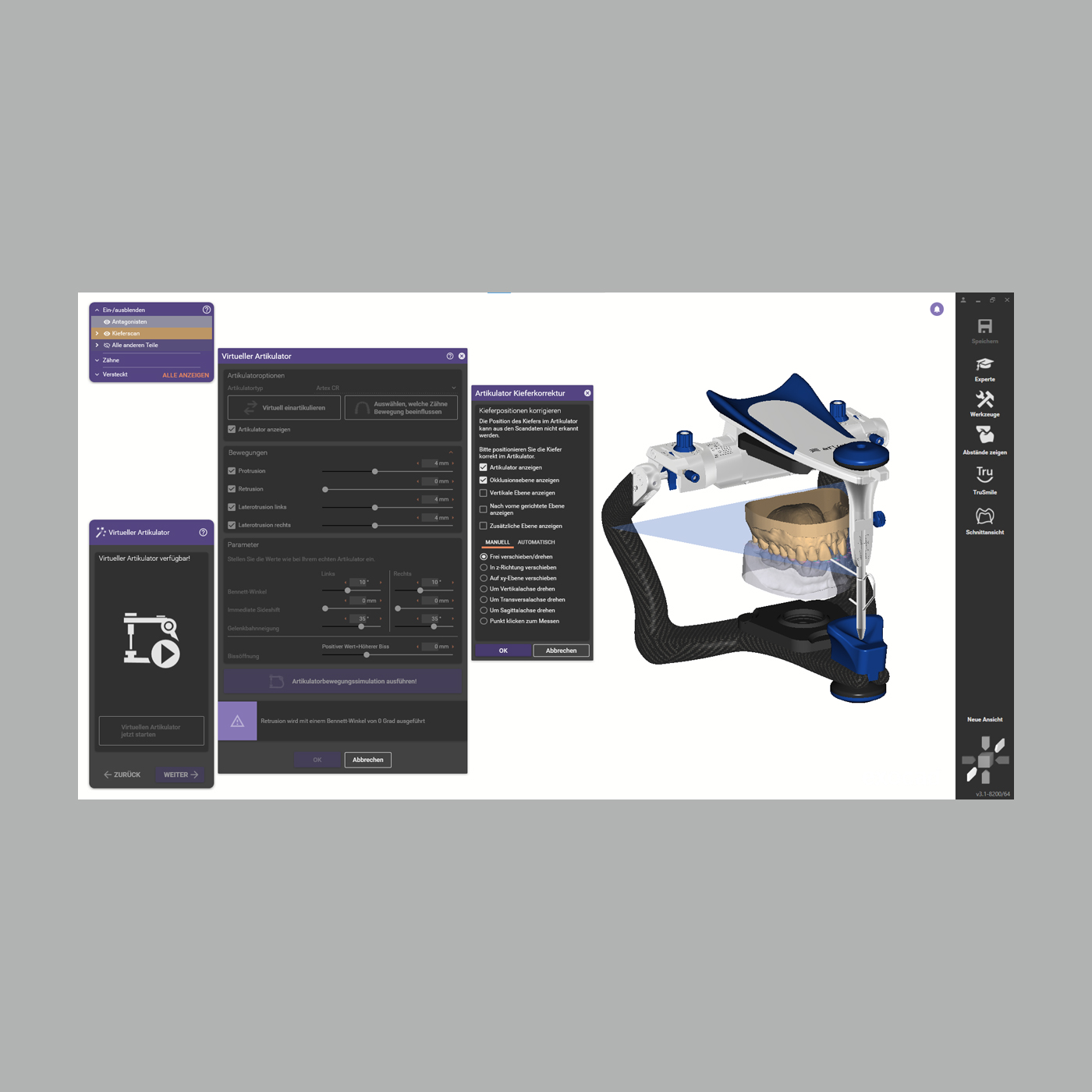 FINO DENTALART Virtual Articulator