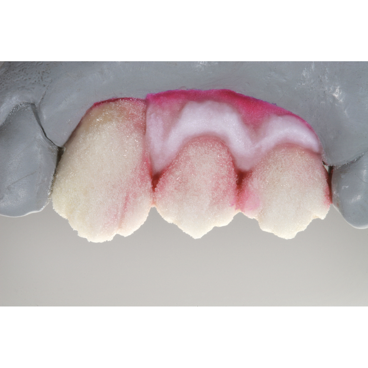 GC Initial MC Gum Shade Powder Opaque Set Veneering Porcelain