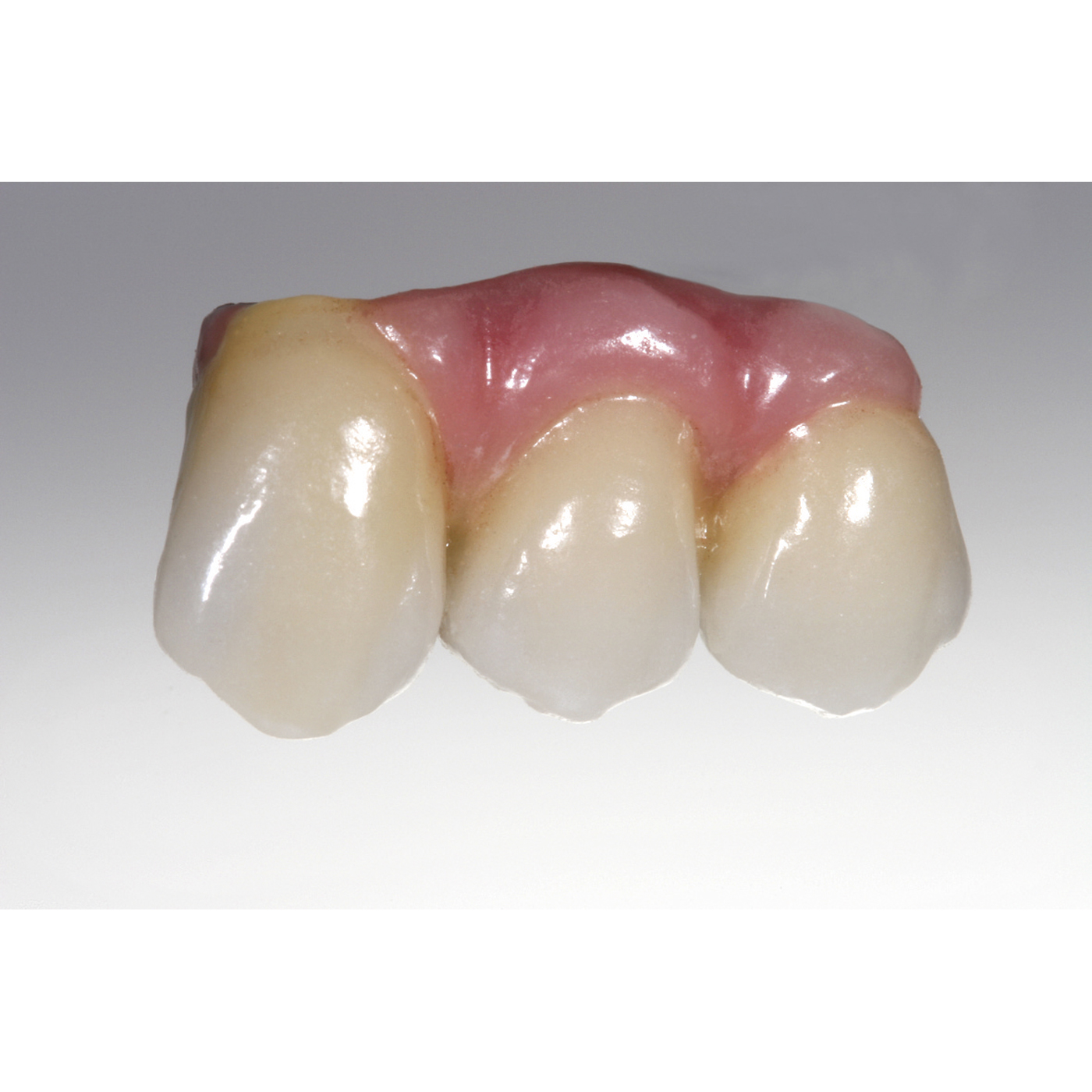 GC Initial MC Gum Shade Powder Opaque Set Veneering Porcelain