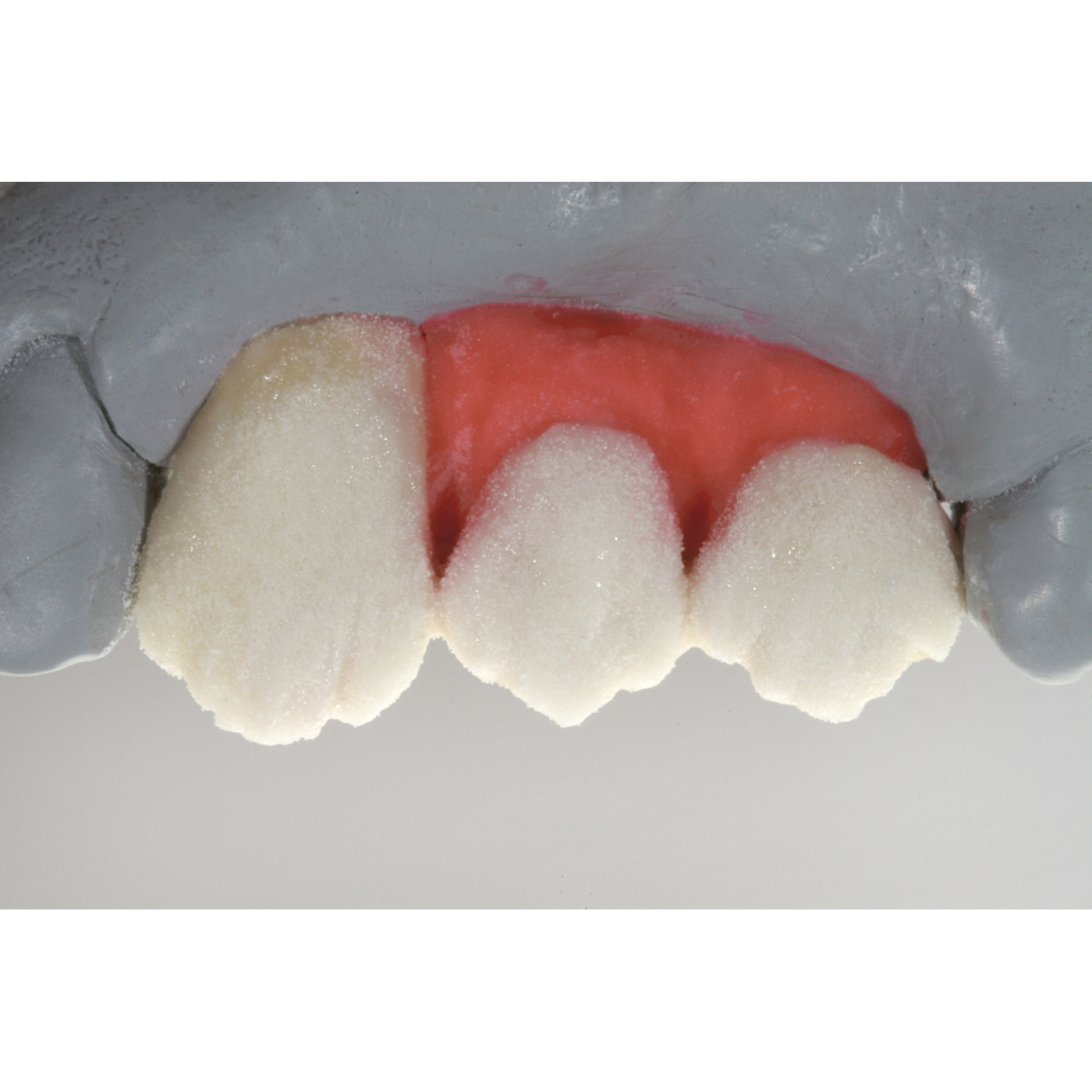 GC Initial MC Gum Shade Powder Opaque Set Veneering Porcelain