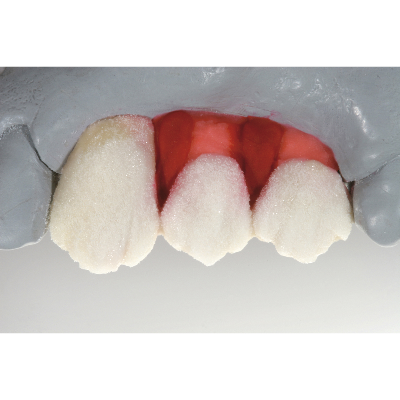 GC Initial MC Gum Shade Powder Opaque Set Veneering Porcelain