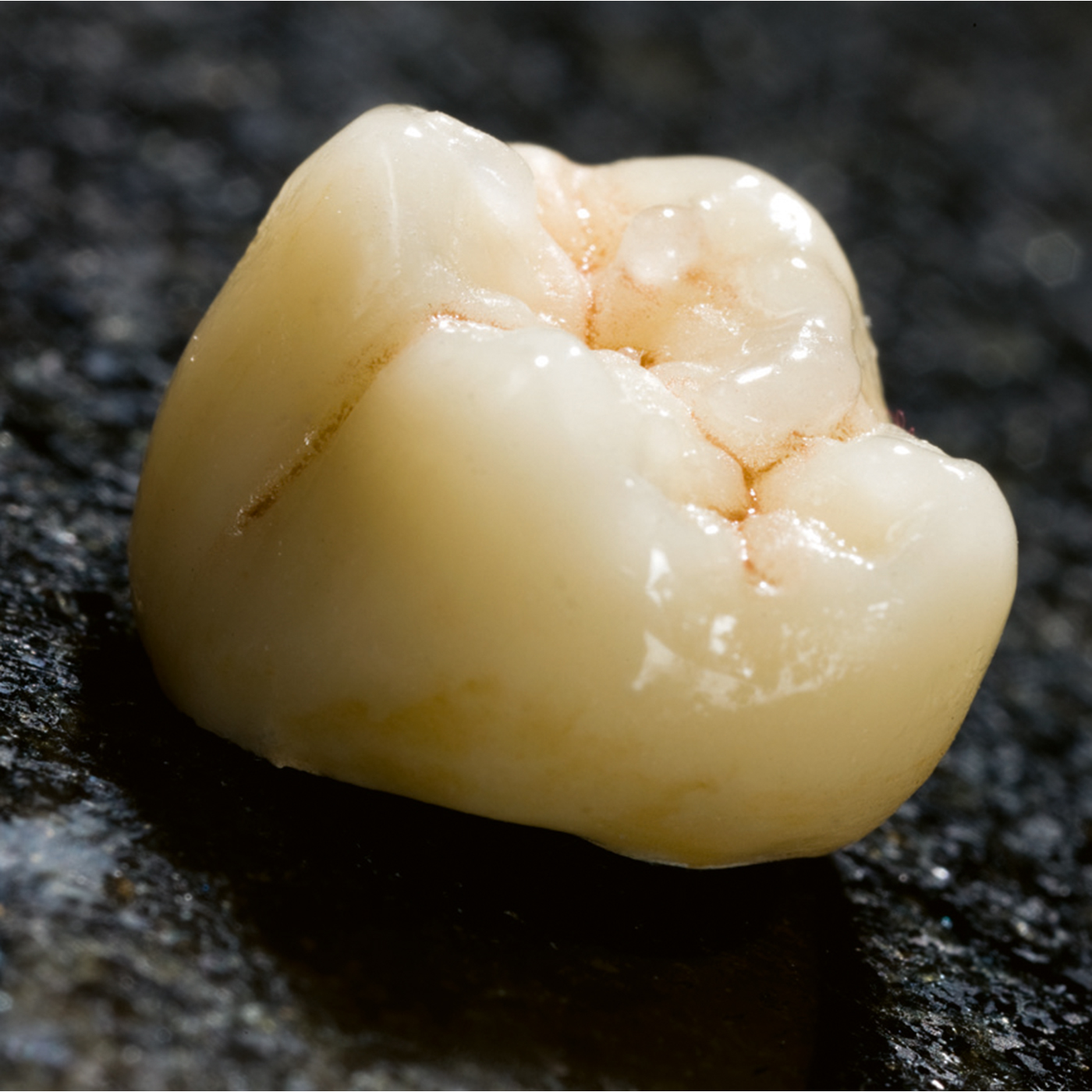 Dentsply Sirona Ceramco iC Dentin/Enamel Ingots, A3.5