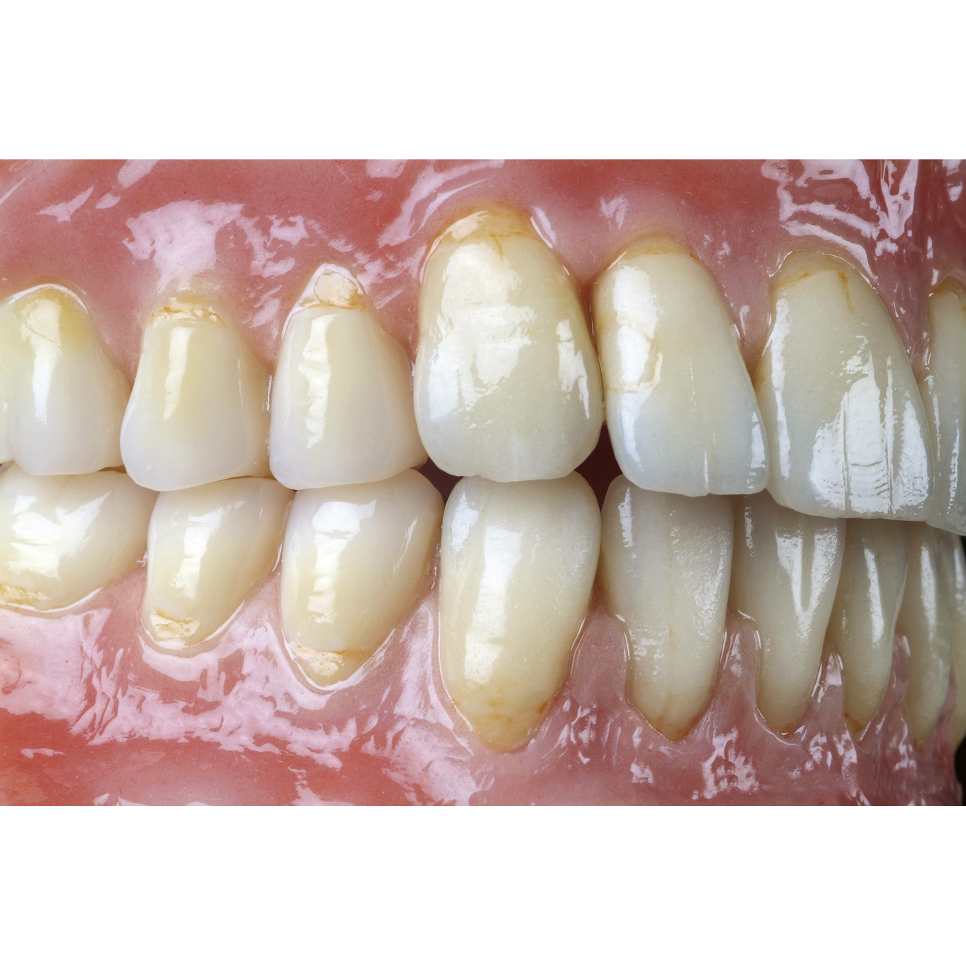 Candulor C-Plast Tray Material, Polymer, Dark Pink