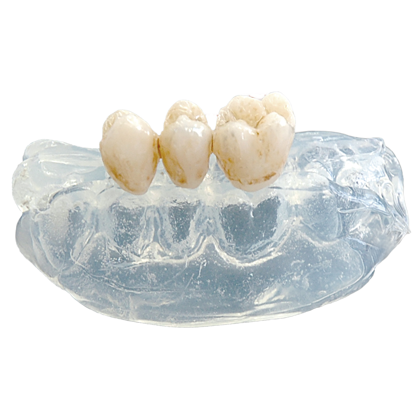 Dreve Laborsil clear silicone, clear transparent