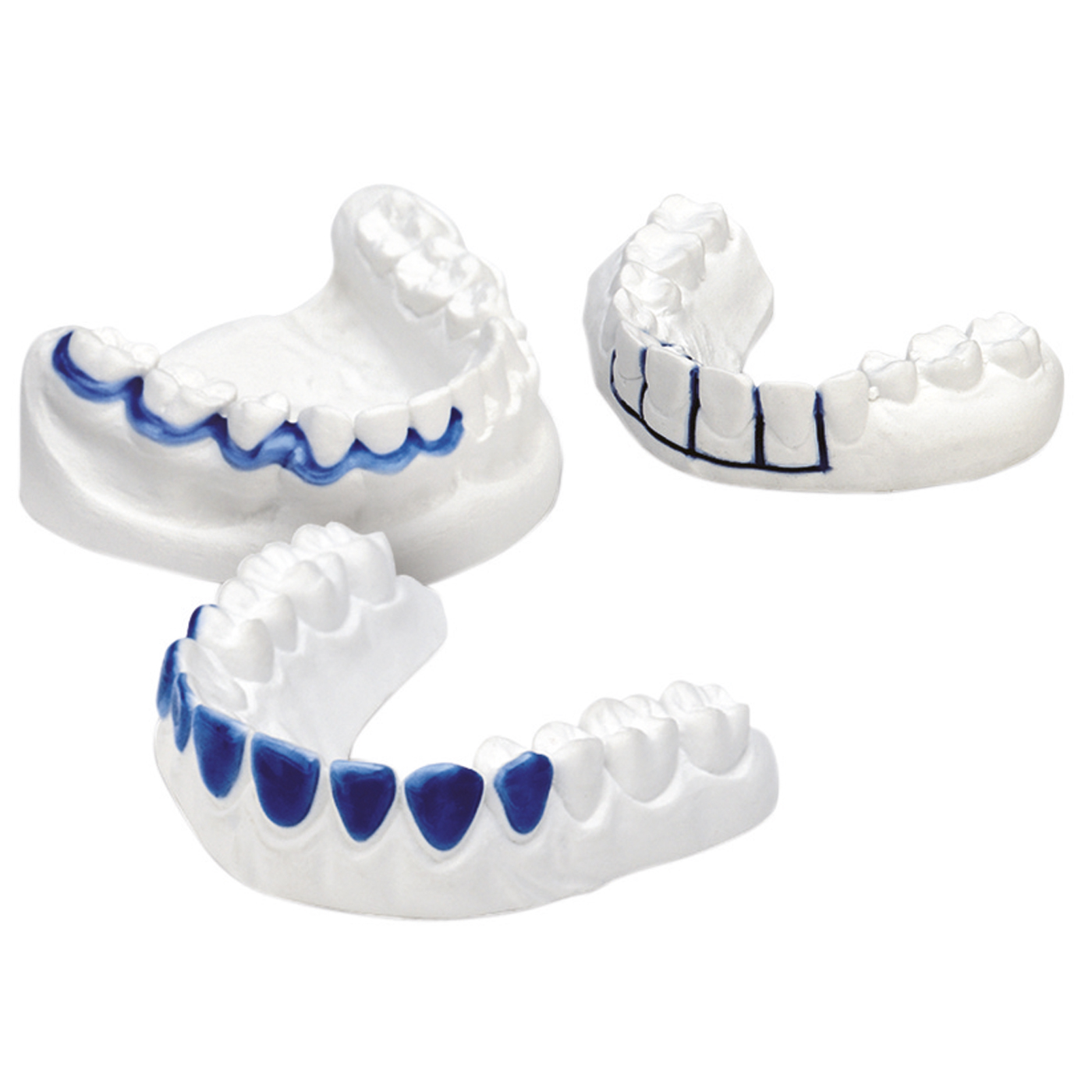 Scheu-Dental Blue-Blokker Block-Out Material