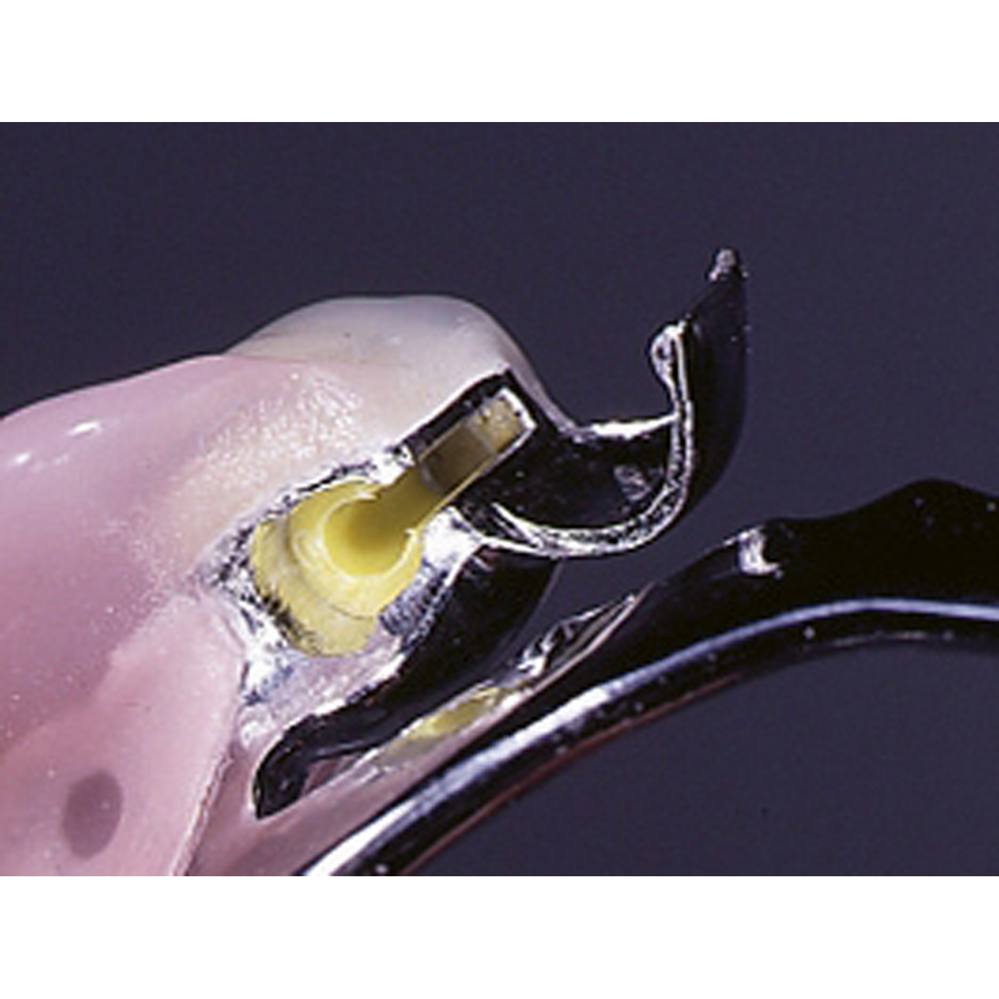 Ceka Preci-Line Preci-Vertix Standard Stabgeschiebe
