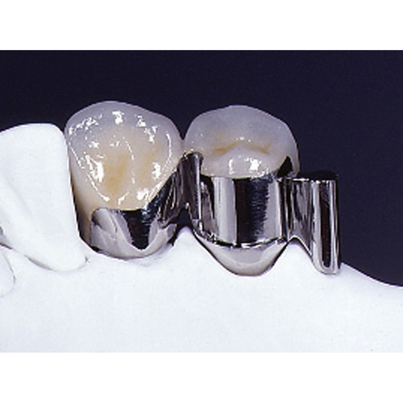 Ceka Preci-Line Preci-Vertix P - ataches de barra